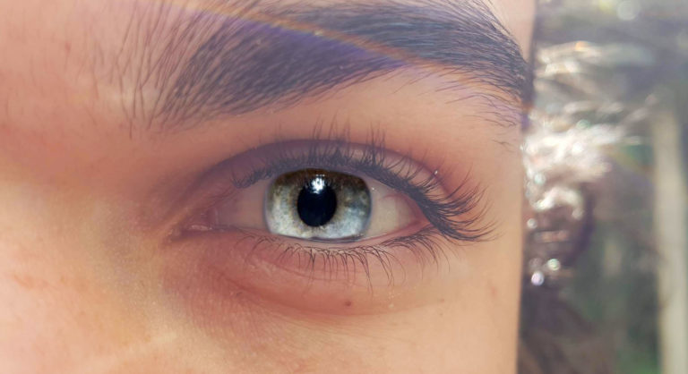 Strabismes - Ophtalmologie Rive Gauche - Toulouse